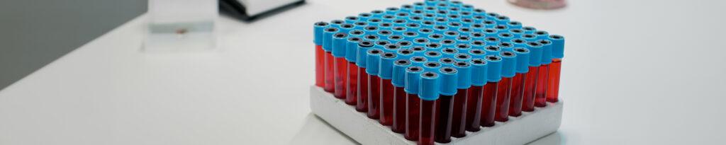 Your blood is gold! Learn about components of blood and symptoms and ...